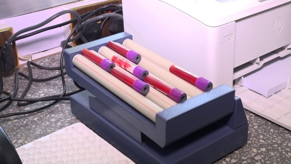 Benadir Hospital receives lab support from Italian Military in Somalia ...